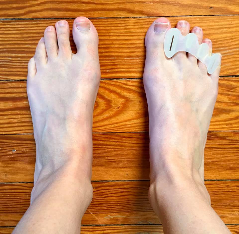 Correct Toes Review A Detailed Review By BarefootJulian Correct Toes Review A Detailed Review By BarefootJulian